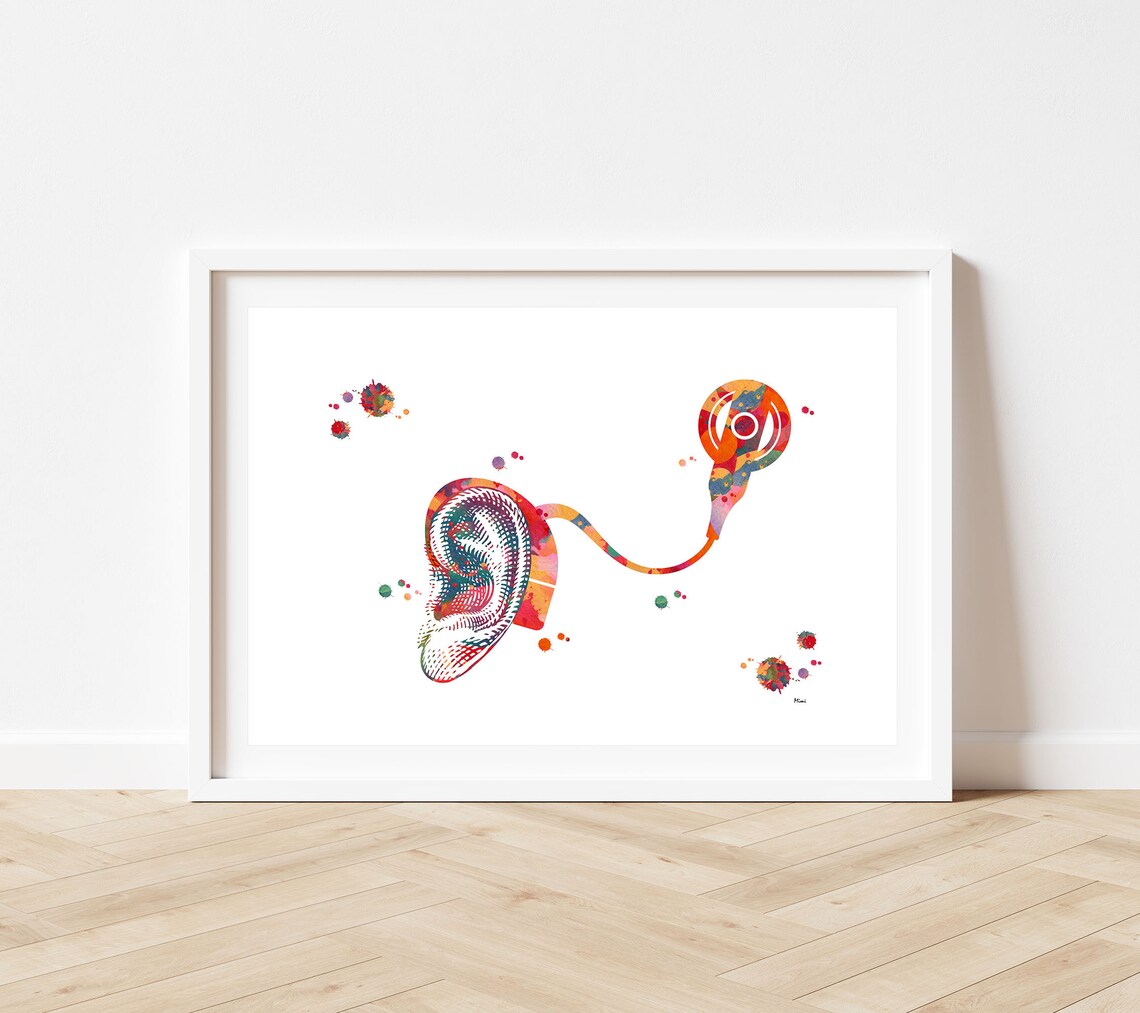 Cochlear Implant Watercolor Print Audiology Poster Inner Ear | Etsy