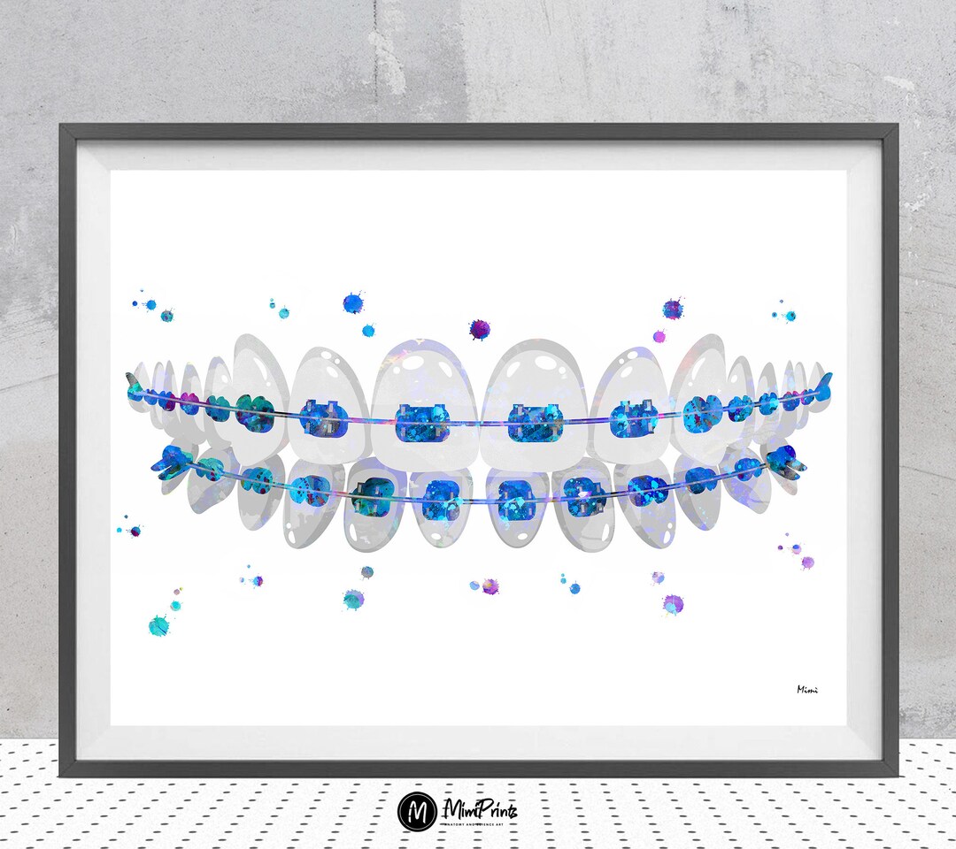 Teeth Brackets Watercolor Dental Illustration in Blue Tones Braces ...