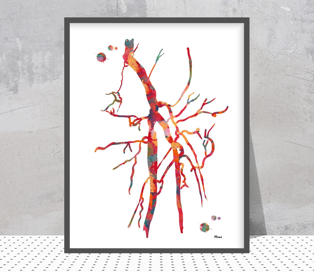 Angiography Print Femoral Spf Artery Occlusion Watercolor Abstract ...