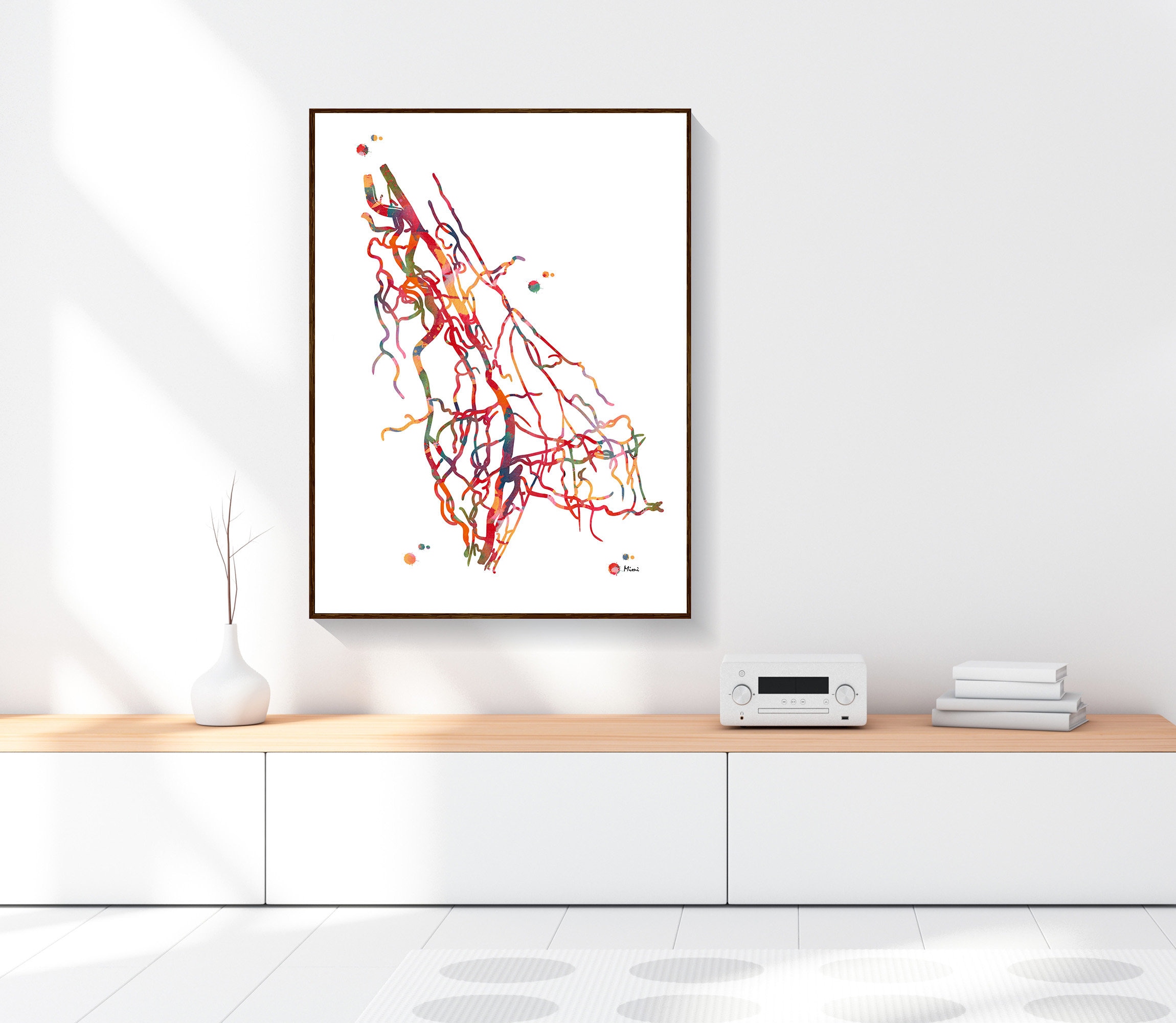 Upper Limb Arteries Angiography Print, Angiogram Watercolor Anatomy Art ...