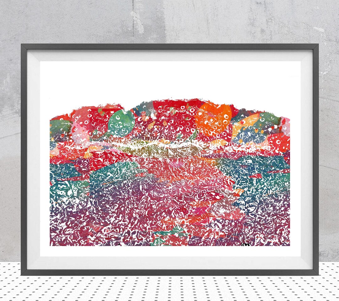 Sun Damaged Skin Histology Print Photoaging Watercolor Solar Elastosis ...