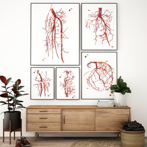 Angiogram Print Popliteal Artery Watercolor Angiography Painting of the ...