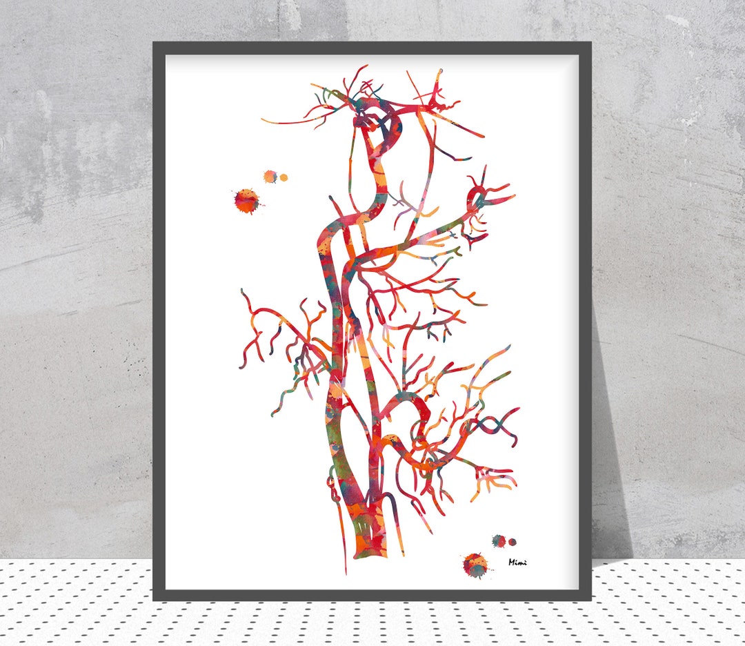 Angiography Print Carotid Artery Watercolor Angiogram Abstract Anatomy ...