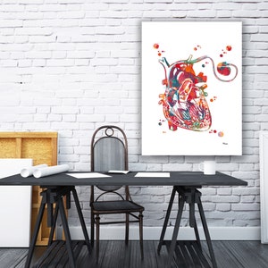 Heart Pacemaker Watercolor Print Anatomy Art Cardiac External Pacemaker ...
