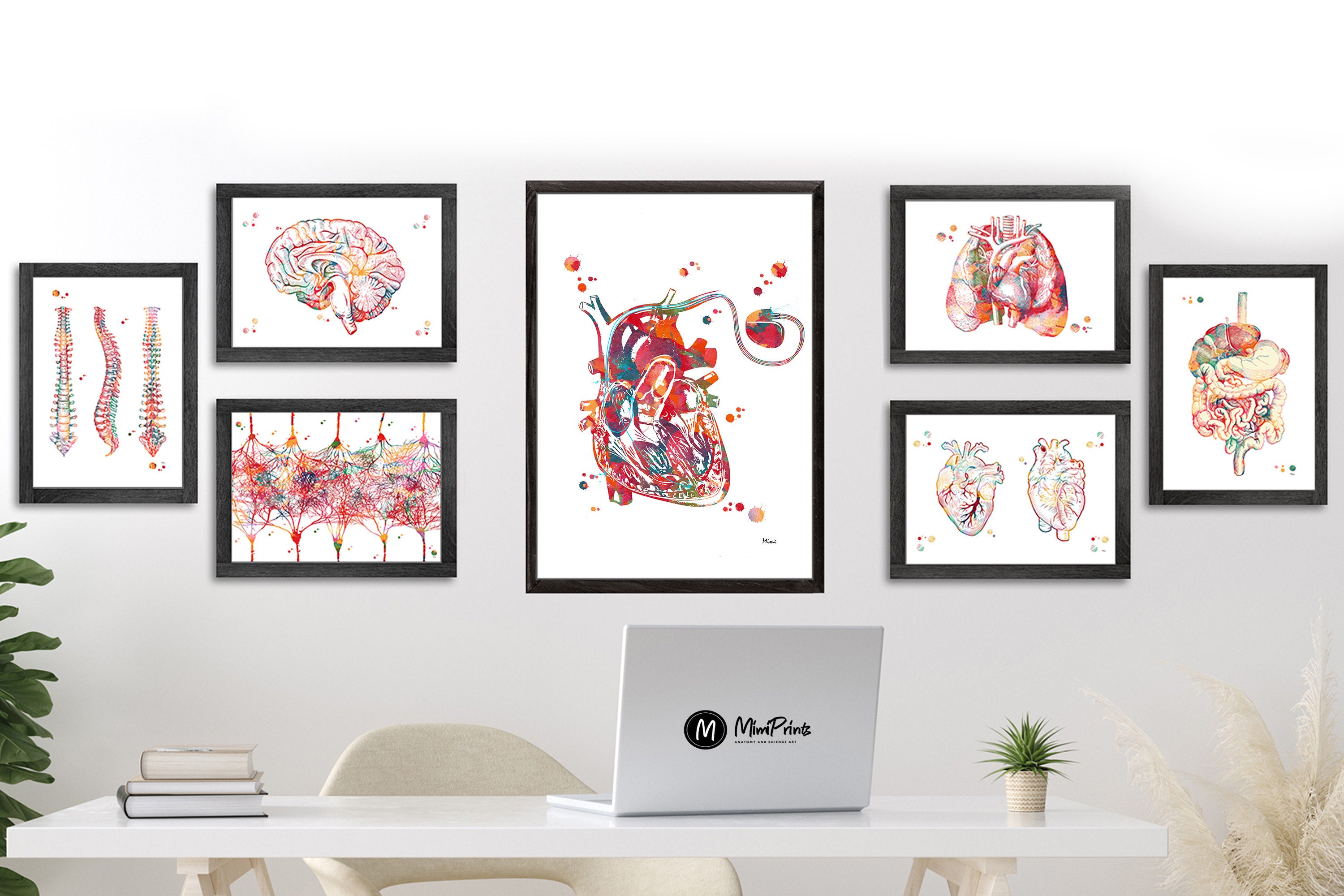 Heart Pacemaker Watercolor Print Anatomy Art Cardiac External Pacemaker ...