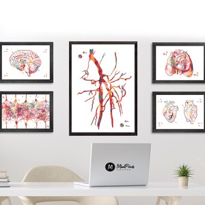 Angiography Print Femoral Spf Artery Occlusion Watercolor Abstract ...