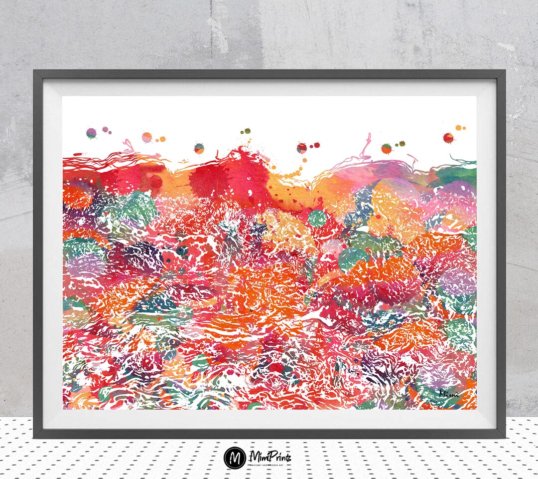 Skin Dermatitis Anatomy Print Dermatology Poster Microscopic View of ...