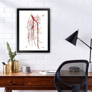 Angiogram Print Popliteal Artery Watercolor Angiography Painting of the ...