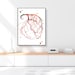 Heart Vascularization Print Coronary Angiogram Poster Cardiology Art ...