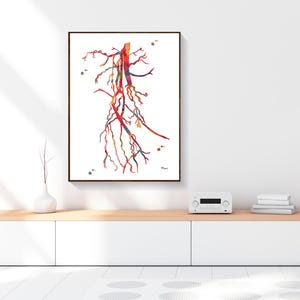 Angiography Watercolor Print: Femoral Artery Anatomy Art - Etsy