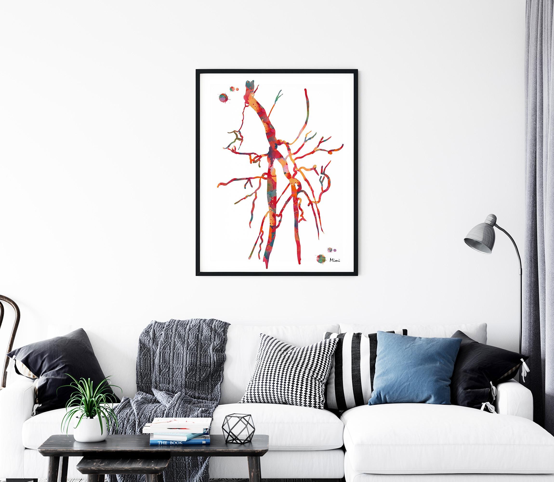 Angiography Print Femoral Spf Artery Occlusion Watercolor Abstract ...