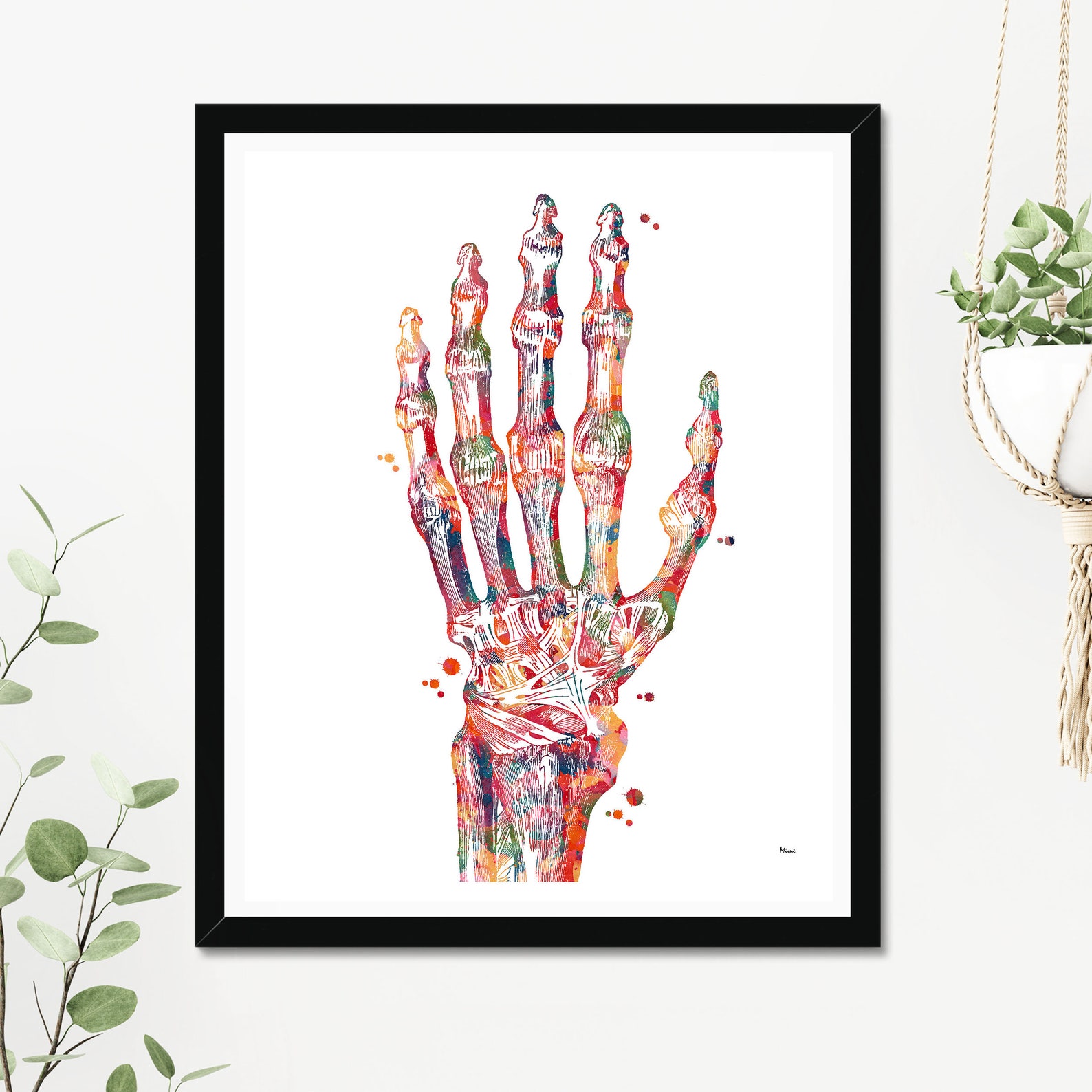 Hand Bones Anatomy Art Print Radiocarpal Joint Poster Wrist | Etsy