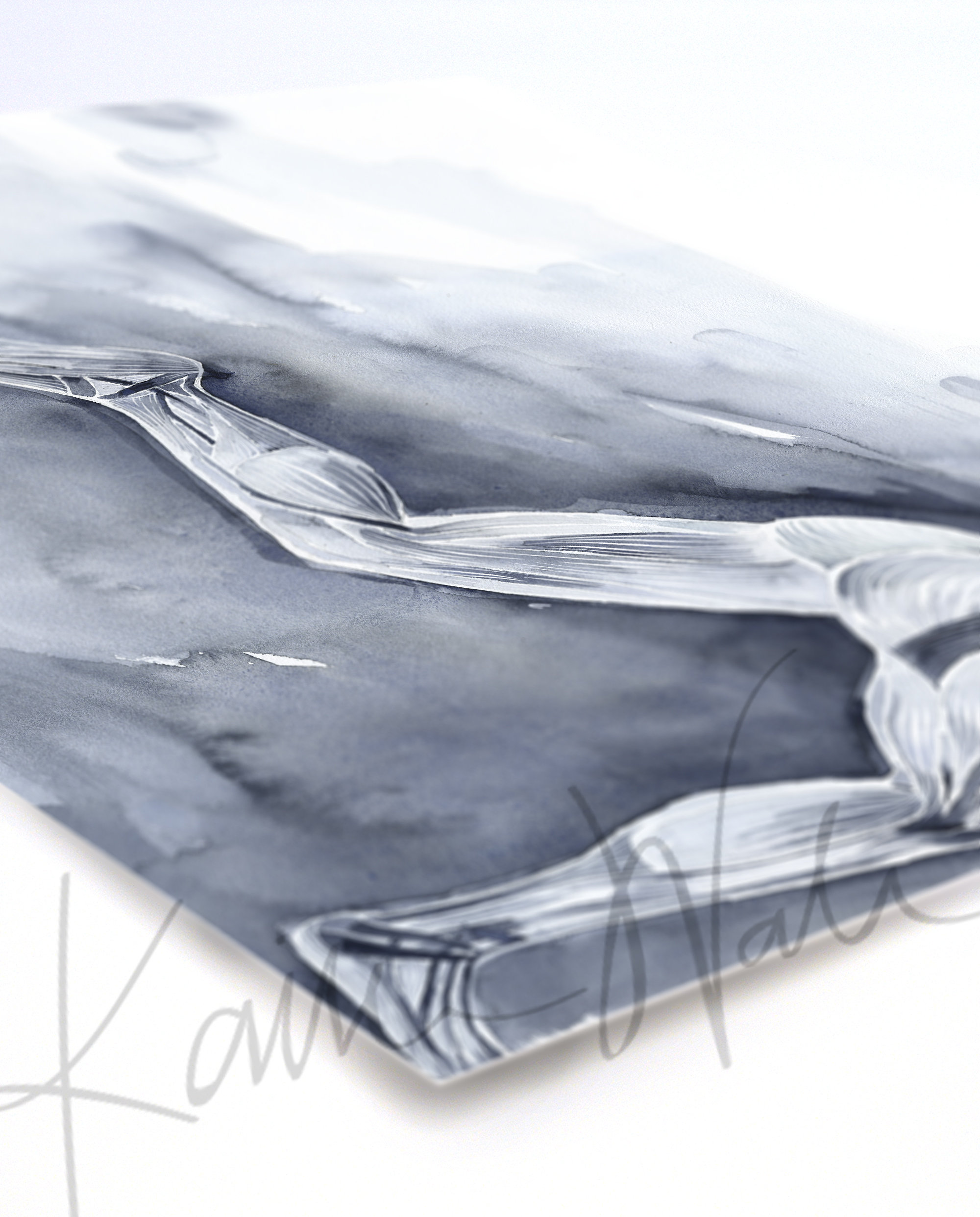 Tendons & Ligaments Watercolor Print - Plantar Fascia Art - Ligamentous ...