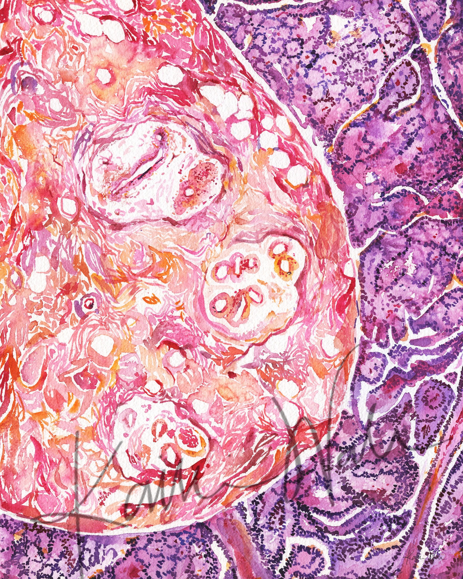 Breast Histology Watercolor Print Cancer Art Histology Art - Etsy