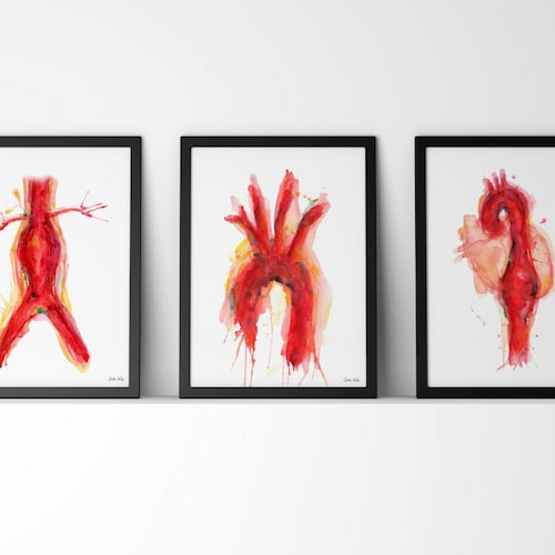 Aorta Angiogram Watercolor Art Print Cardiovascular Painting - Etsy