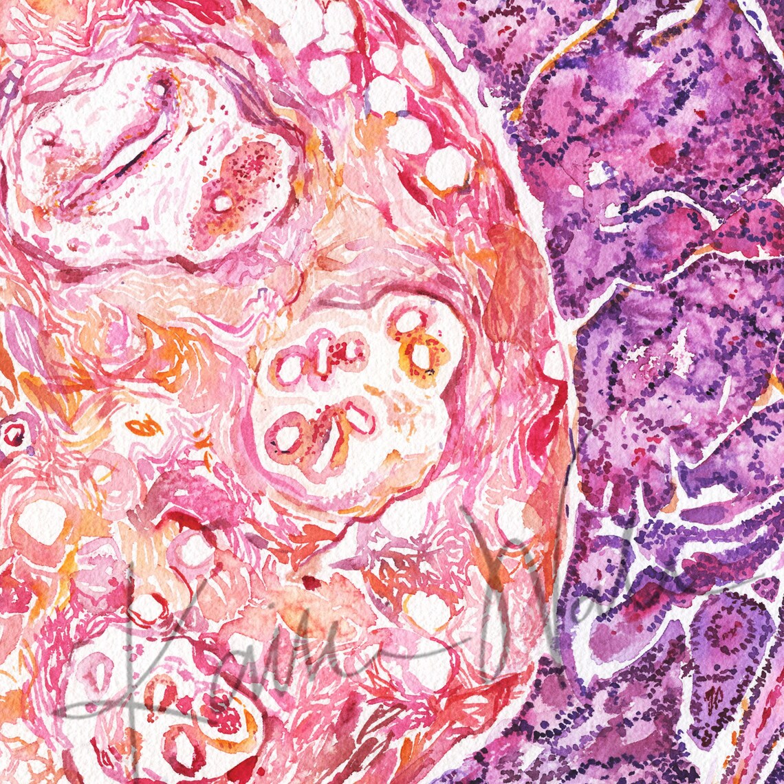 Breast Histology Watercolor Print Cancer Art Histology Art - Etsy Australia