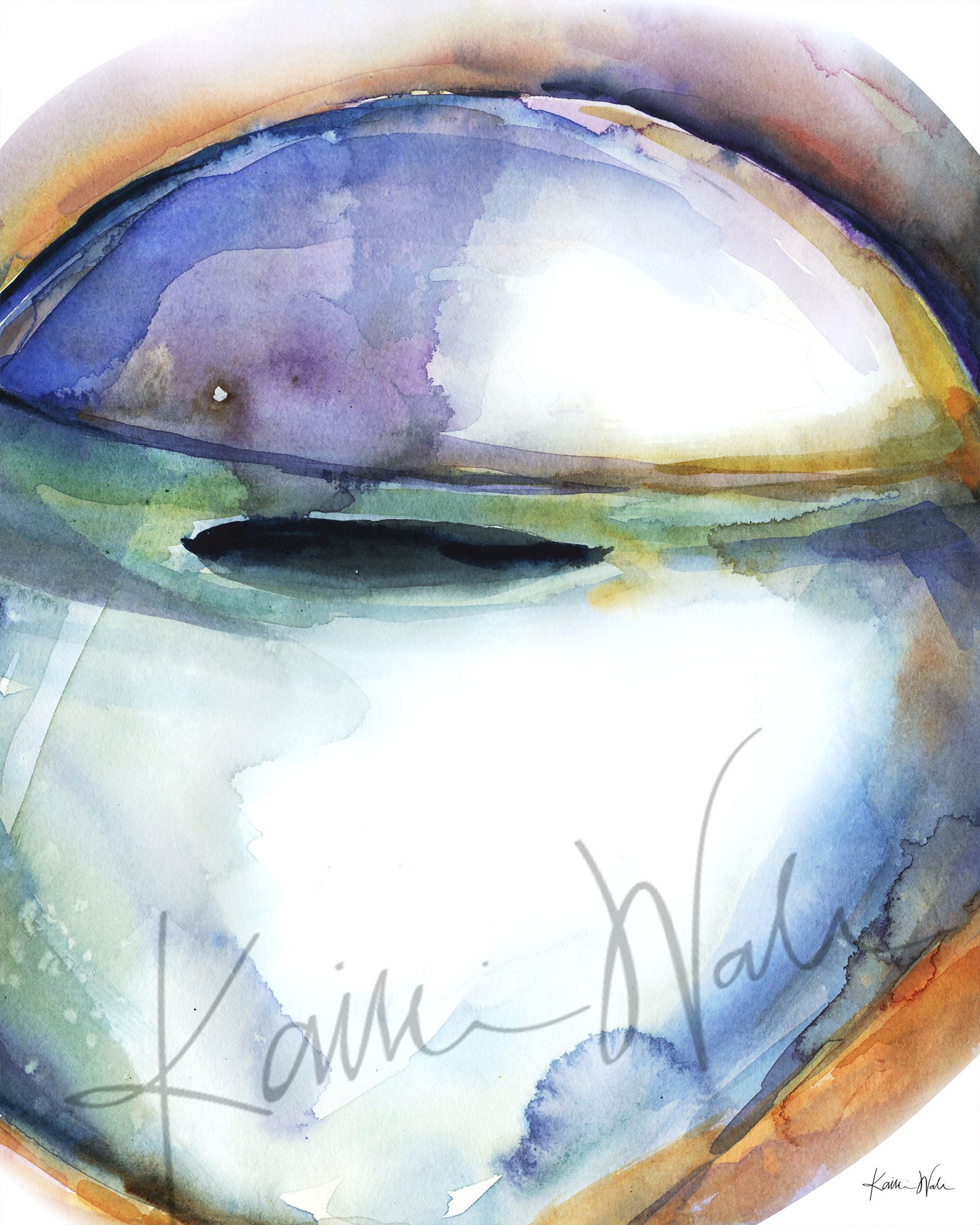 Bulging Cornea Watercolor Print - Keratoconus - Optometry Art - Etsy