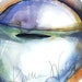 Bulging Cornea Watercolor Print - Keratoconus - Optometry Art - Etsy