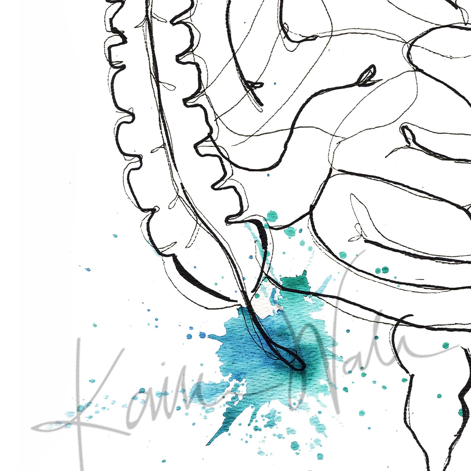 Appendicitis Watercolor Print - GI Anatomy Art - Gastrointestinal ...