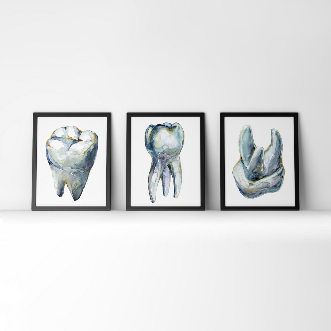 Set of 3 Molar Views Prints - Dental and OMFS Art Set - Teeth ...
