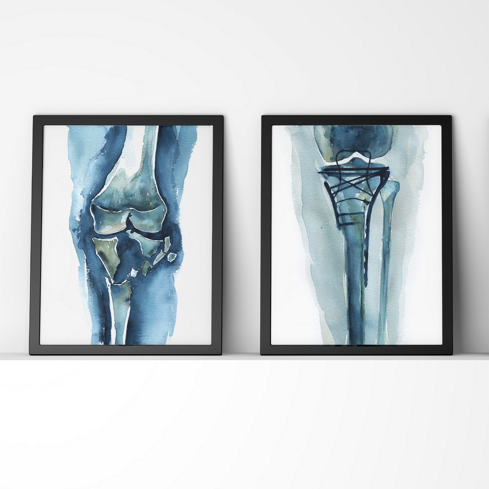 Knee Repair Watercolor Print Set Orthopedics Print | Etsy
