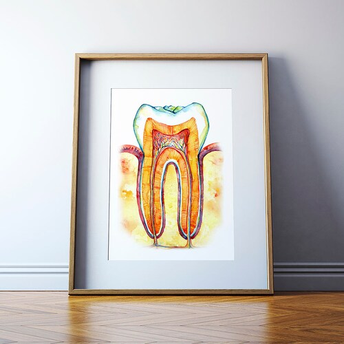 BSSO Watercolor Art Print Mandible Surgery Abstract Anatomy | Etsy