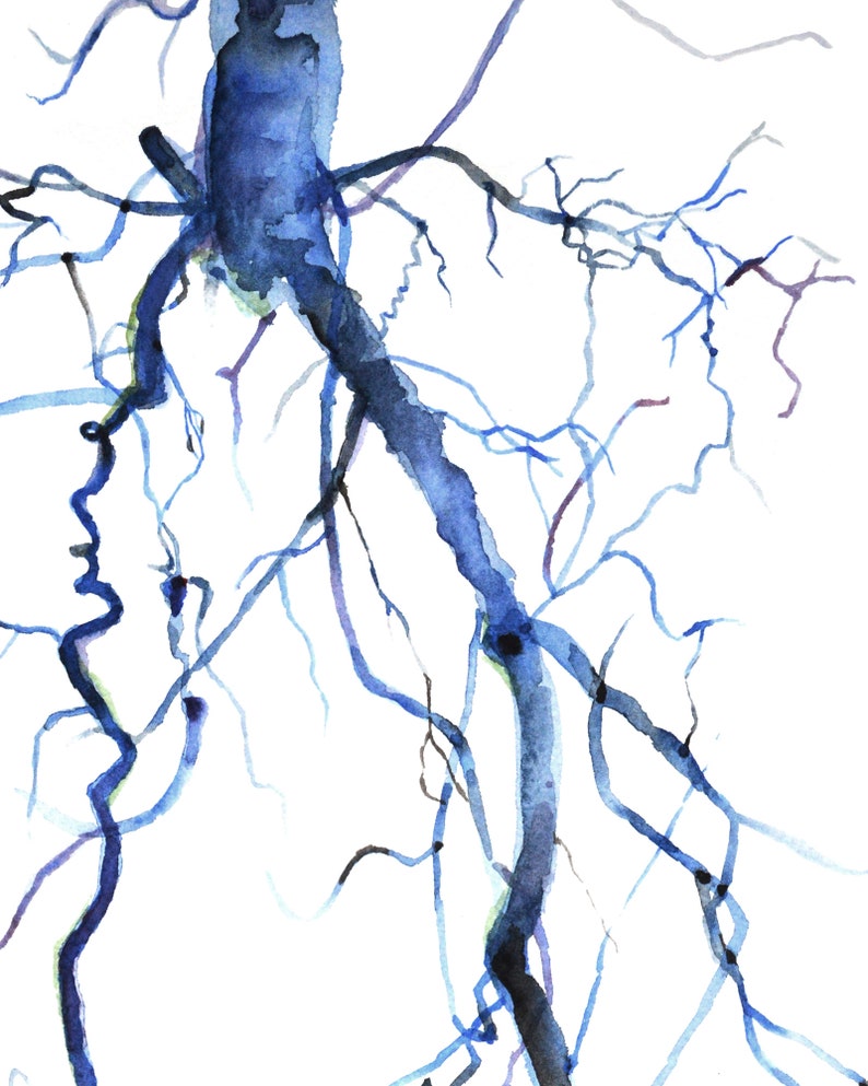 Aorta Angiogram Watercolor Art Print - Cardiovascular Painting - Blood ...