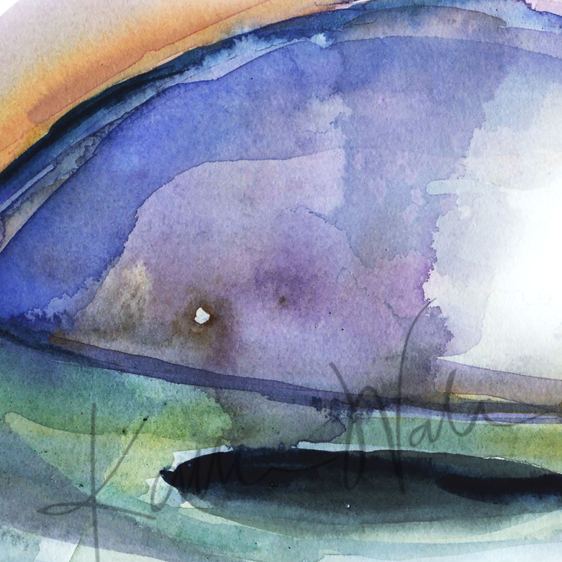 Bulging Cornea Watercolor Print - Keratoconus - Optometry Art - Etsy
