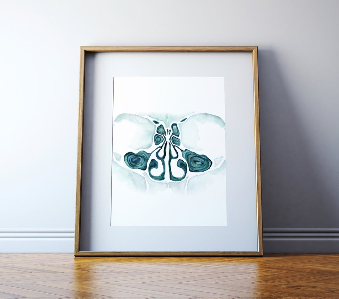 Coronal Section of the Sinuses Watercolor Art Print - ENT and OMFS Art ...