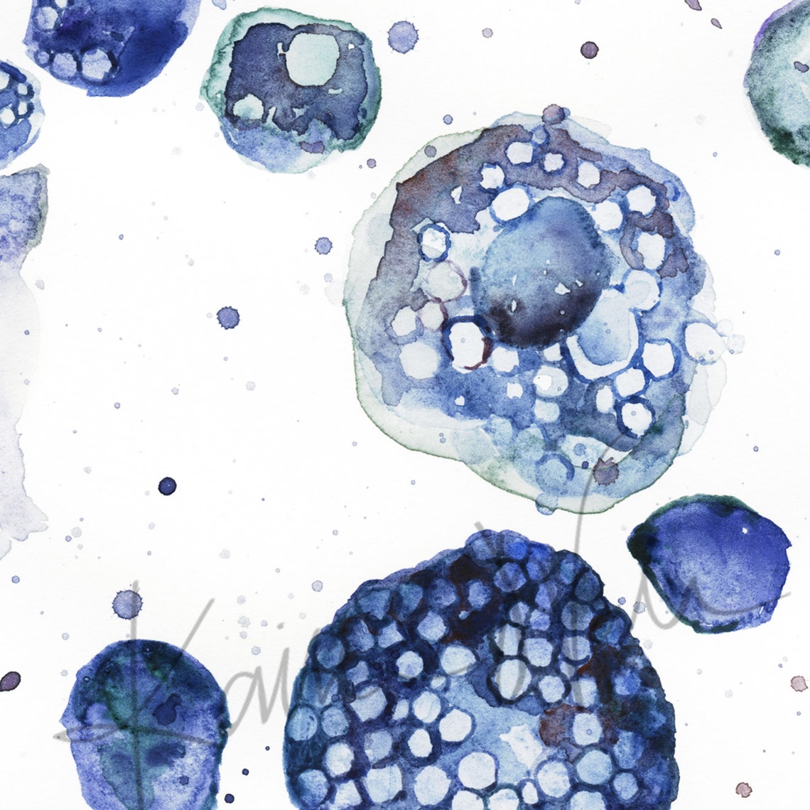 Mott Cells Watercolor Print Histology Art Russell Bodies - Etsy UK