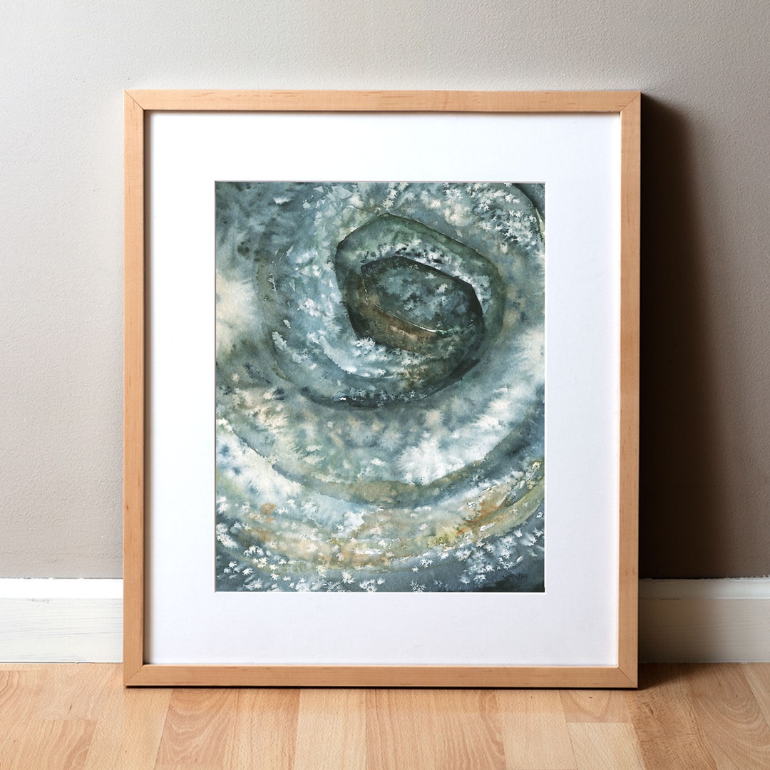 Ulcerative-colitis Colonoscopy Watercolor Print - Abstract Anatomy Art ...