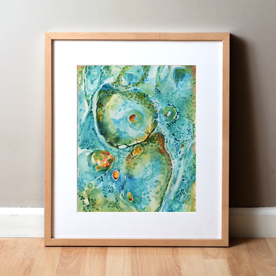 Basal Cell Carcinoma Watercolor Print - Skin Cell Art - Integumentary ...