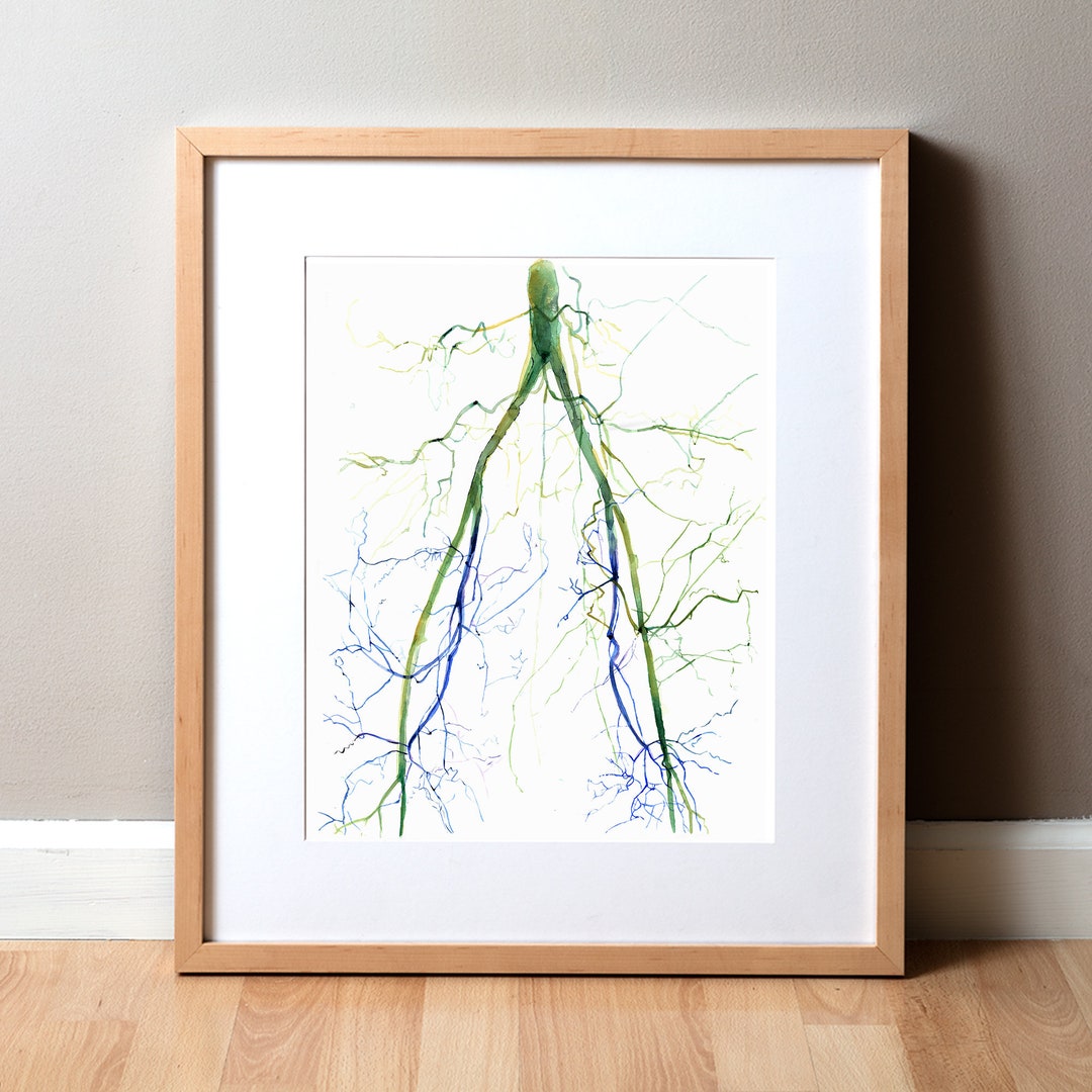 Combined Angiogram Watercolor Print - Cardiology Art - Gift for ...