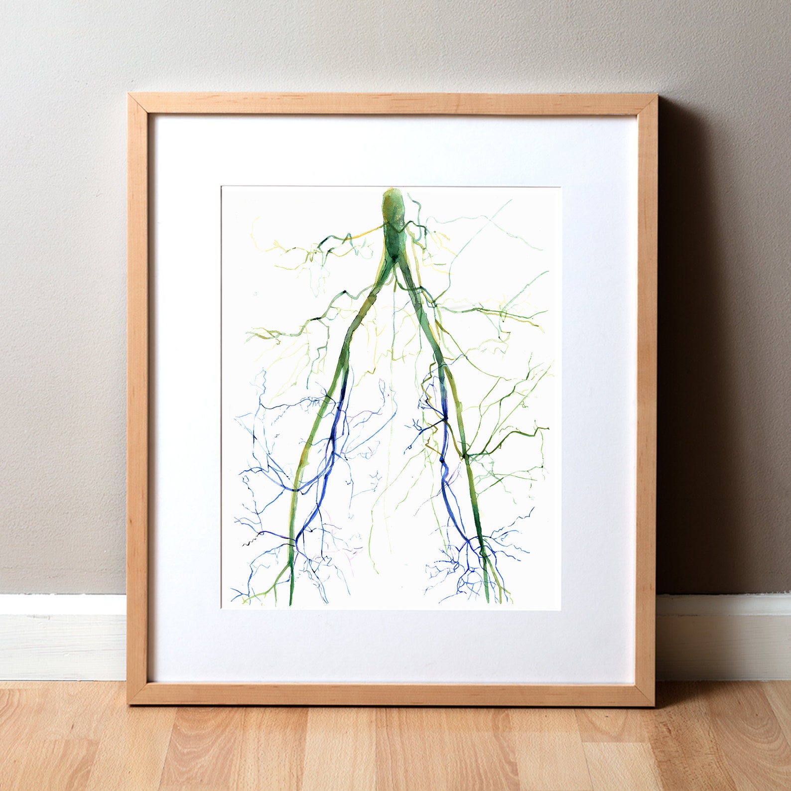 Combined Angiogram Watercolor Print Cardiology Art Gift - Etsy