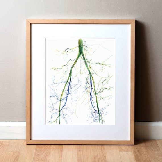 Combined Angiogram Watercolor Print Cardiology Art Gift | Etsy