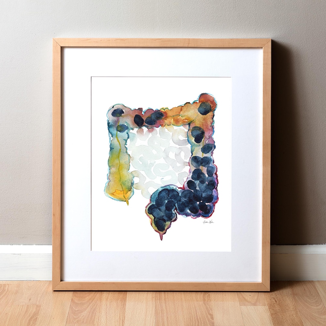 Bound up Colon Watercolor Print - Colonoscopy Art - Abstract Anatomy ...