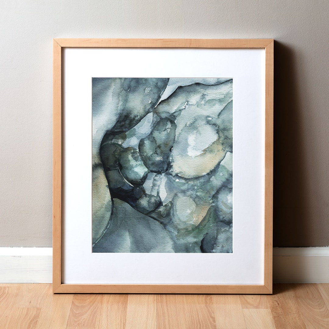 Crohn's Disease Colonoscopy Watercolor Print - Colonoscopy Art - Chrohn ...