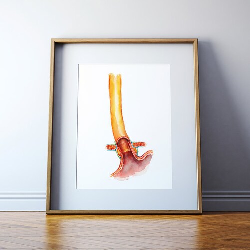 Esophagus Watercolor Art Print Gastrointestinal Painting - Etsy