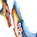 BSSO Watercolor Art Print - Mandible Surgery Abstract Anatomy Art ...