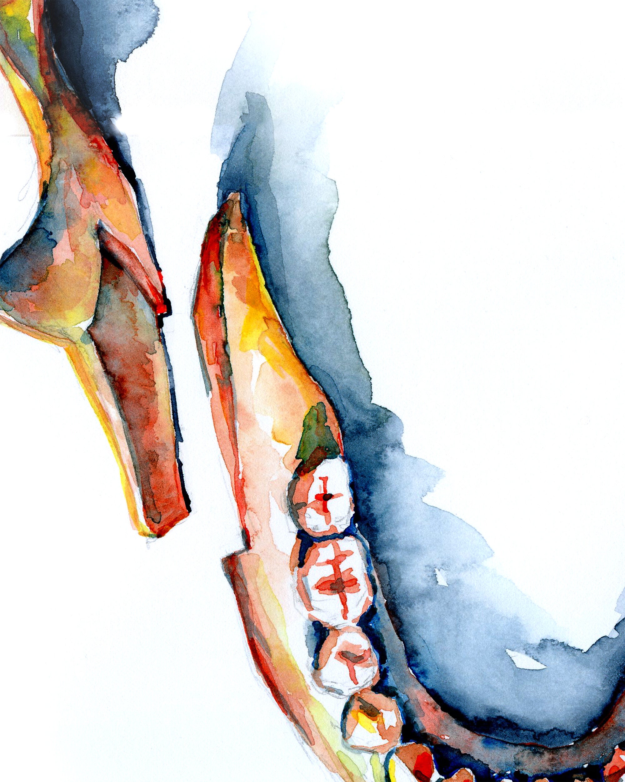 BSSO Watercolor Art Print Mandible Surgery Abstract Anatomy | Etsy