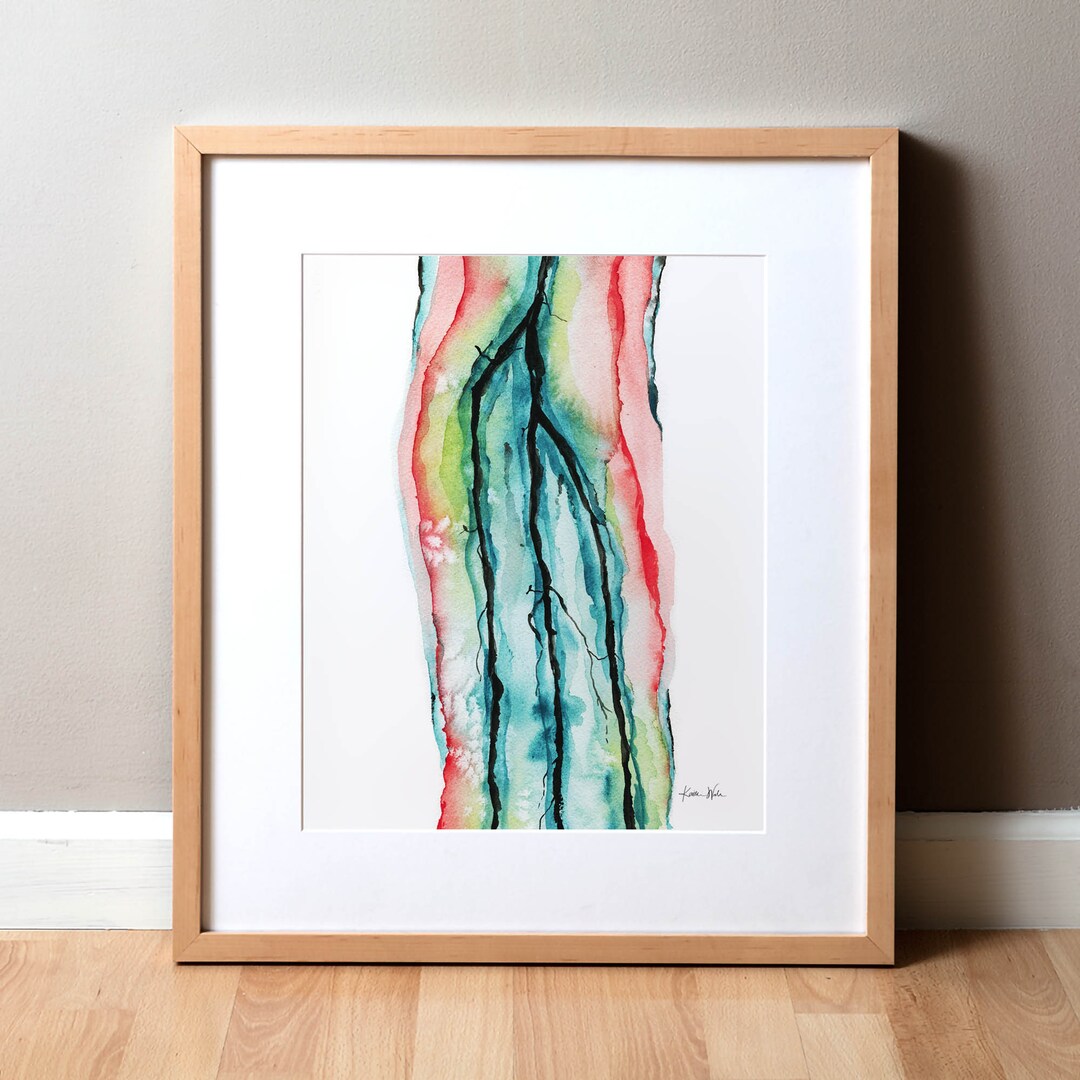 Three Vessel Runoff Watercolor Print - Pulmonology Anatomy Painting - Etsy