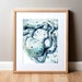 Cells Watercolor Poster Cell Paintings Blood Cells Hematology Art ...
