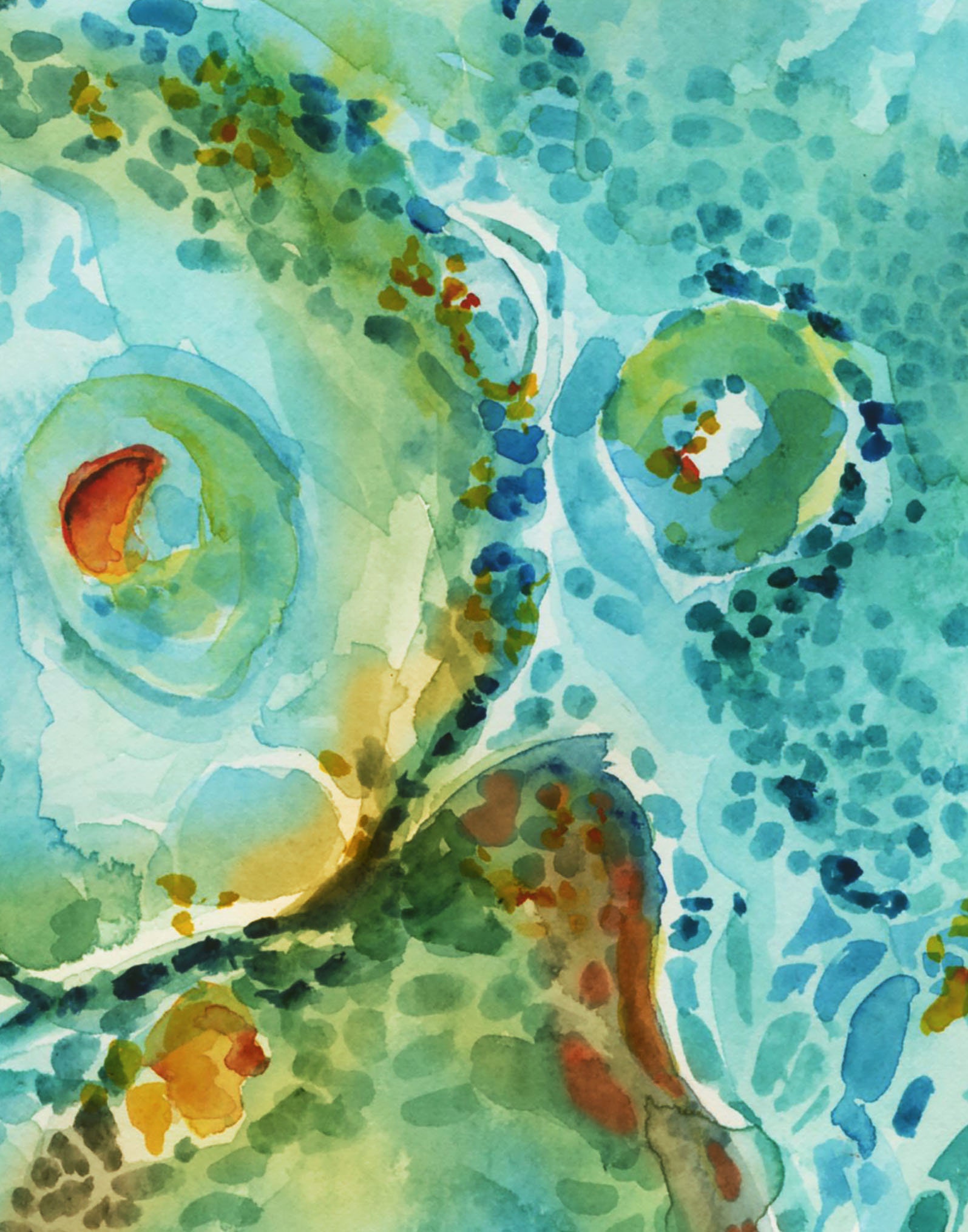 Basal Cell Carcinoma Watercolor Print Skin Cell Art | Etsy
