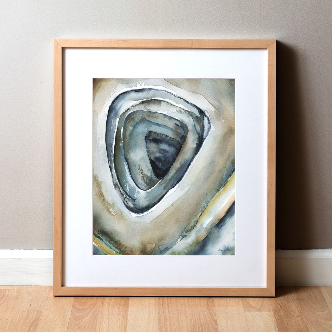 Normal Colonoscopy Watercolor Print - Colonoscopy Art - Abstract ...