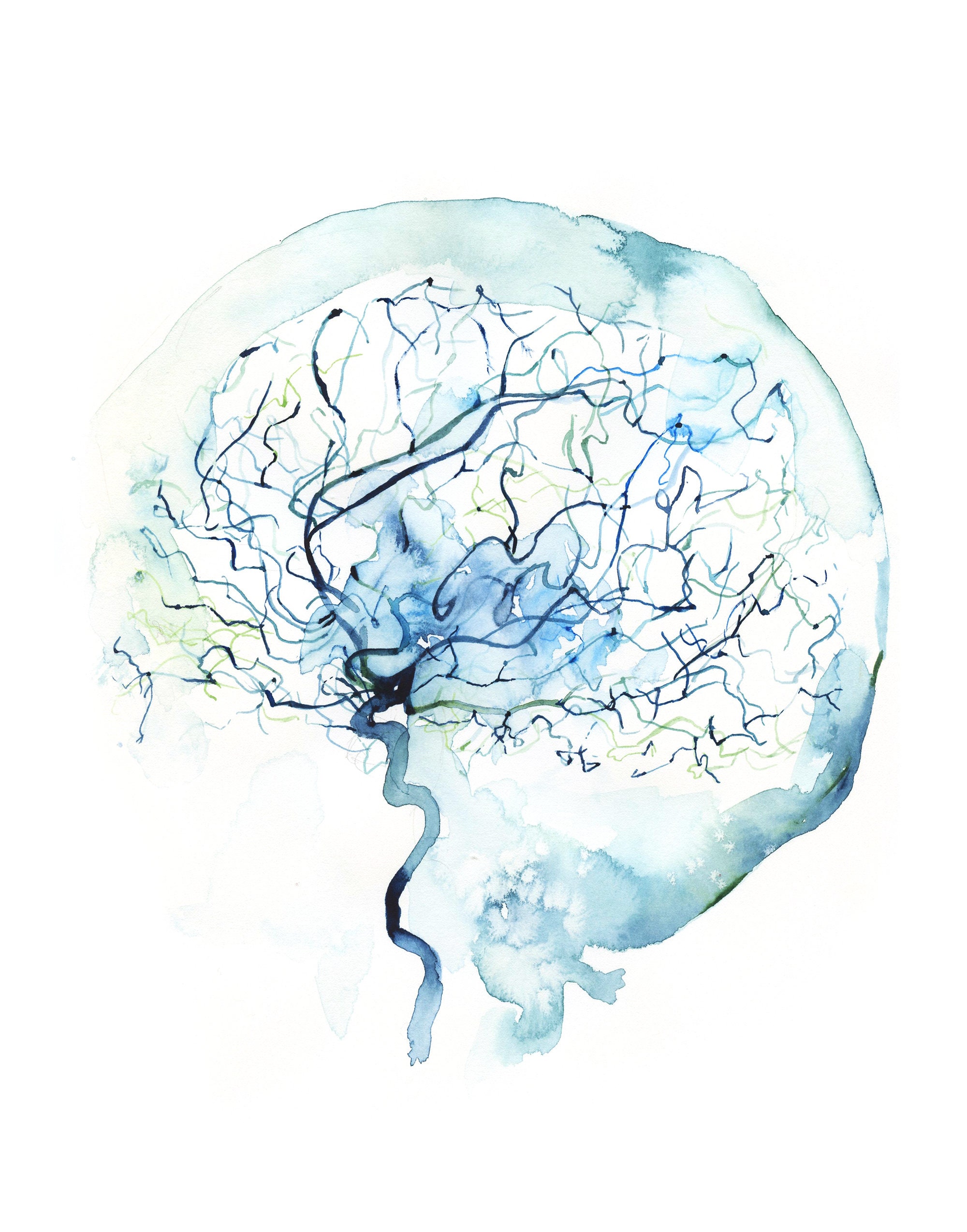 Cerebral Angiography - Brain Art Watercolor - Brain Painting ...
