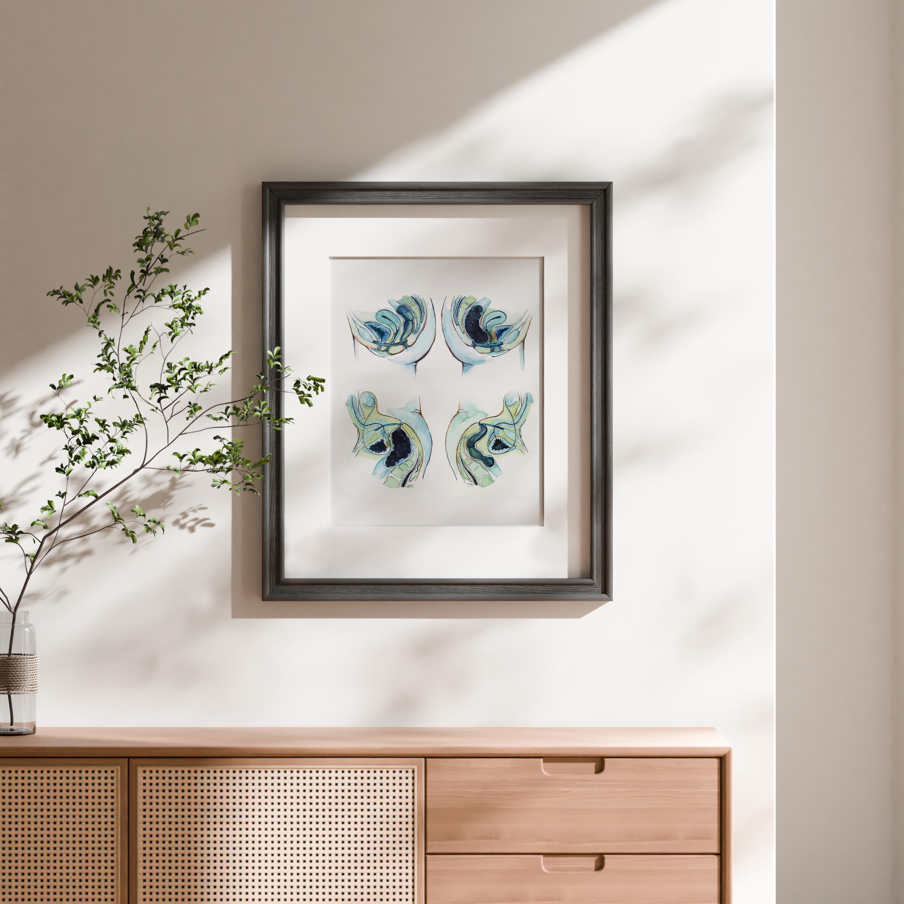 Constipation Cross Section Watercolor Print - GI Anatomy Art - Urology ...
