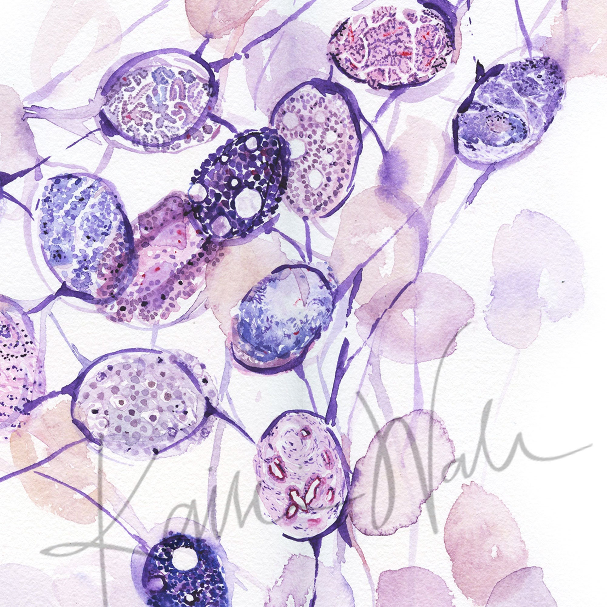 Lymph Nodes Mosaic Watercolor Print Breast Cancer Painting - Etsy