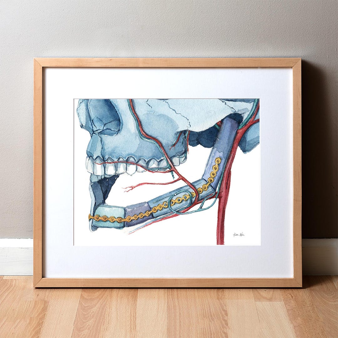 Anastomosis OMFS Watercolor Print - Mandible Surgery Abstract Anatomy ...