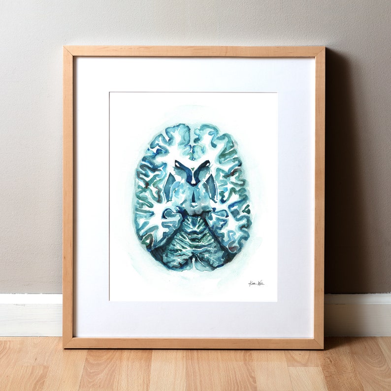 Transverse Brain Watercolor Print Neurology Art Brain Art - Etsy