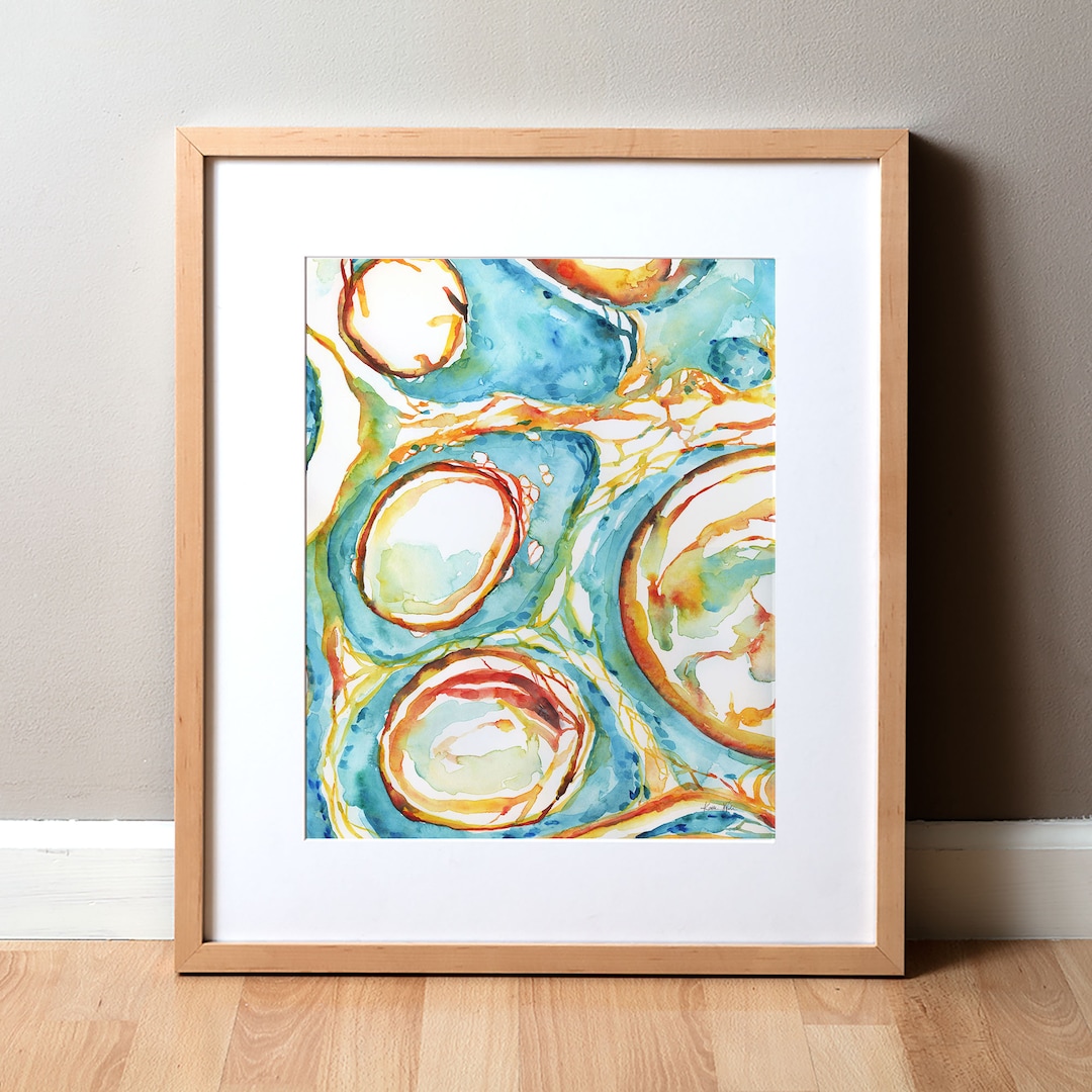 Trichodiscoma Watercolor Print - Skin Cell Art - Integumentary System ...